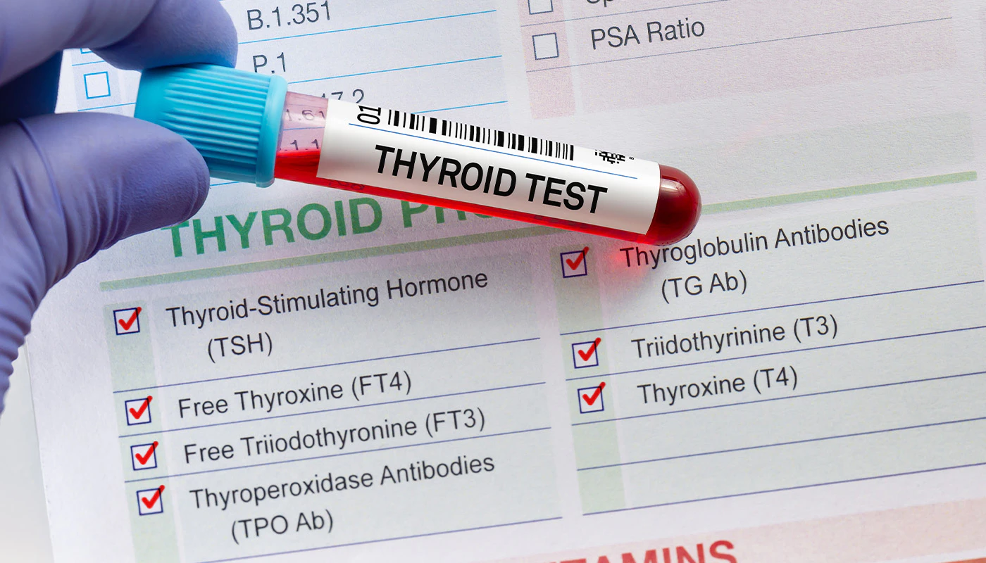 Thyroid Testing