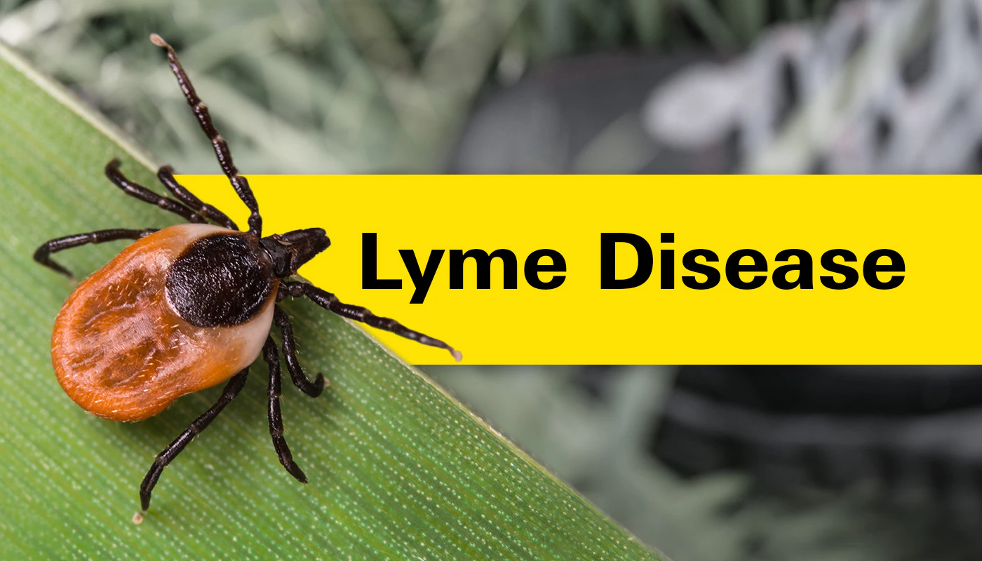 Lyme Disease