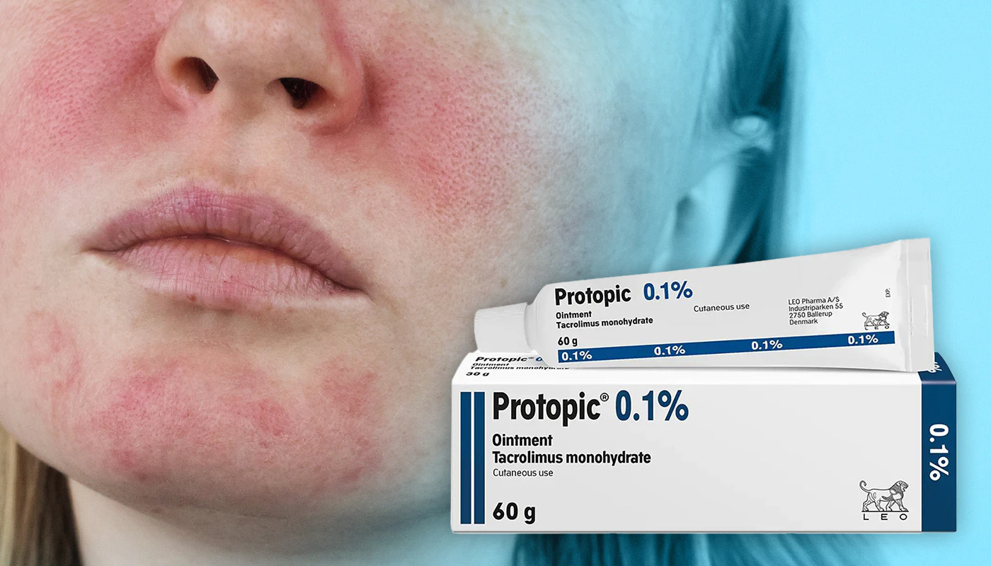Protopic Ointment: What Tacrolimus Ointment Is Used For