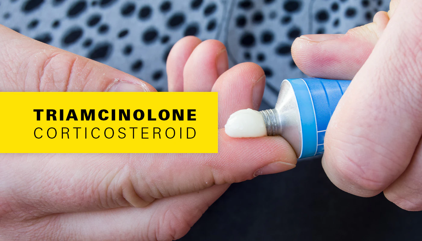 Triamcinolone - Corticosteroid for Eczema and Rheumatoid Arthritis