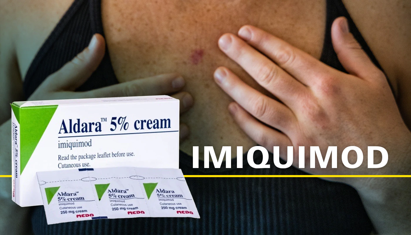 Imiquimod Cream - Uses, Conditions, Side Effects and More.