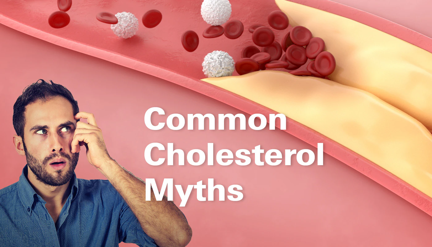 Cholesterol Myths Debunked