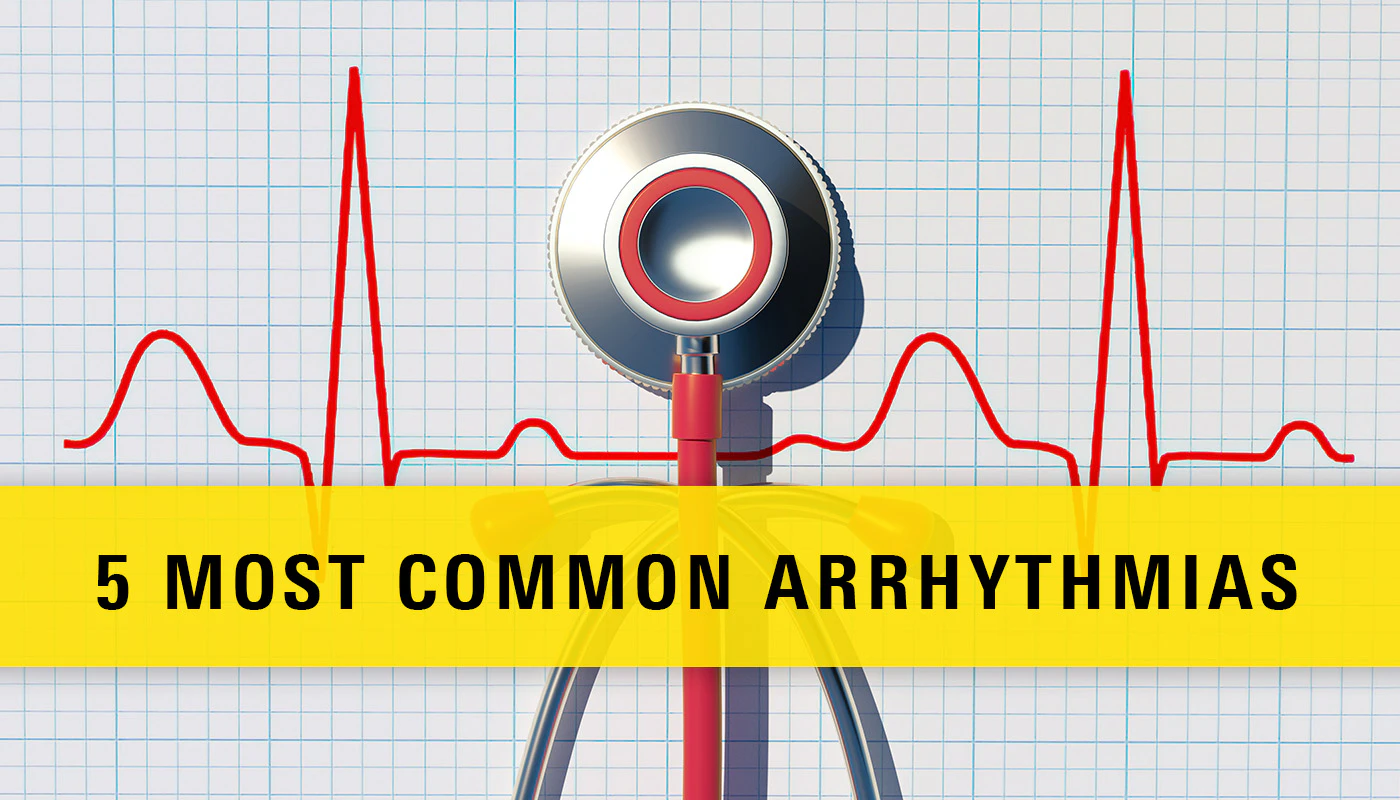 Arrhythmias